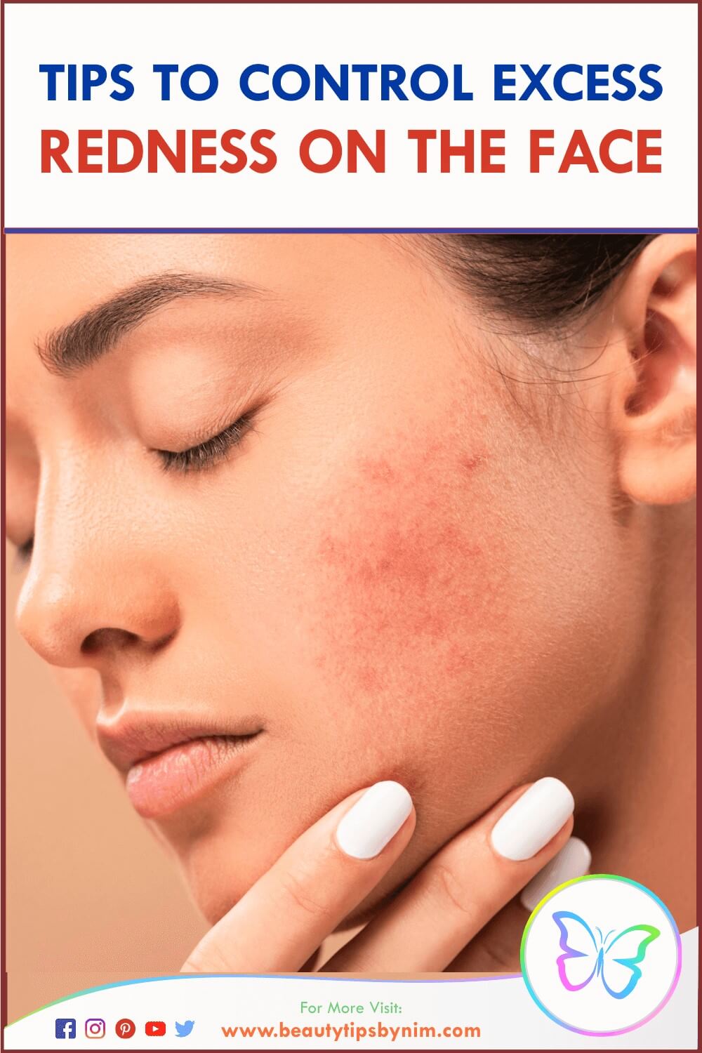 Tips to Control Excess Redness on the Face With Pictures
